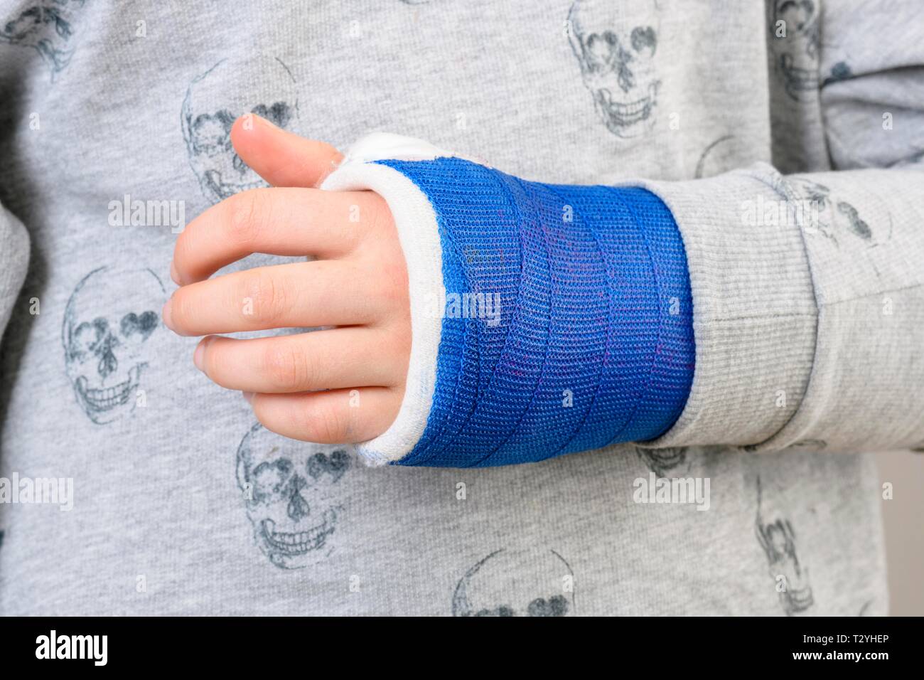 Symbol picture, wrist with plaster cast, Germany Stock Photo - Alamy