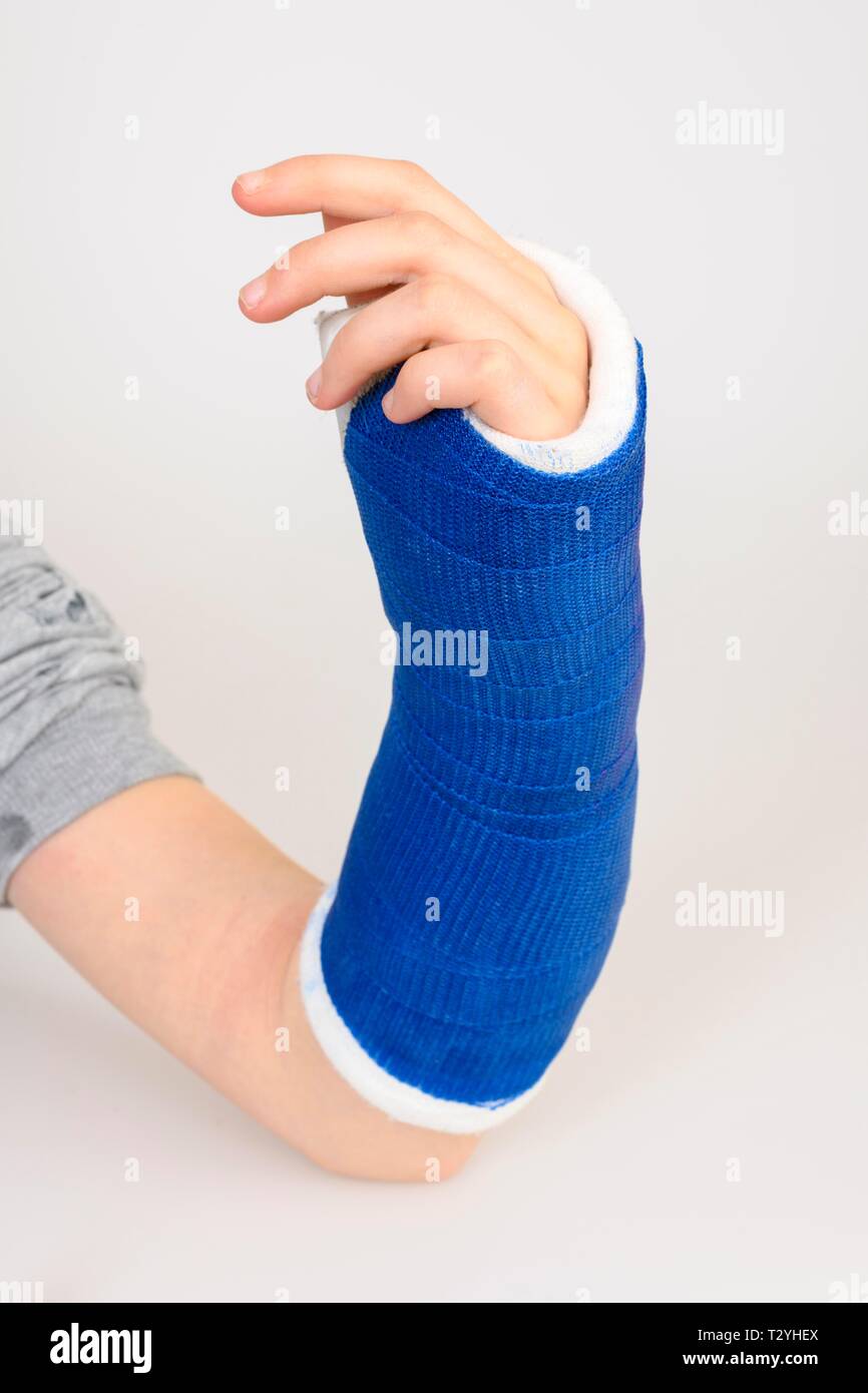 Wrist plaster hi-res stock photography and images - Alamy