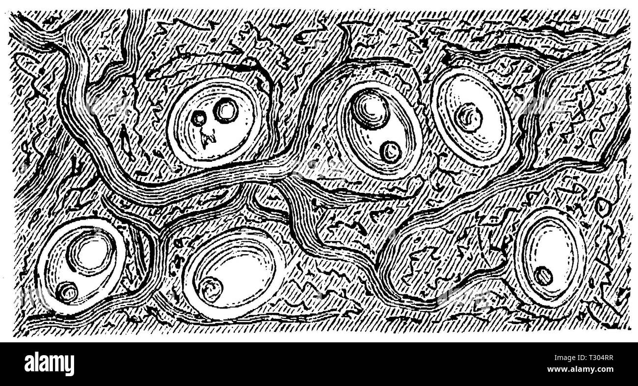 Fibrocartilage Drawing