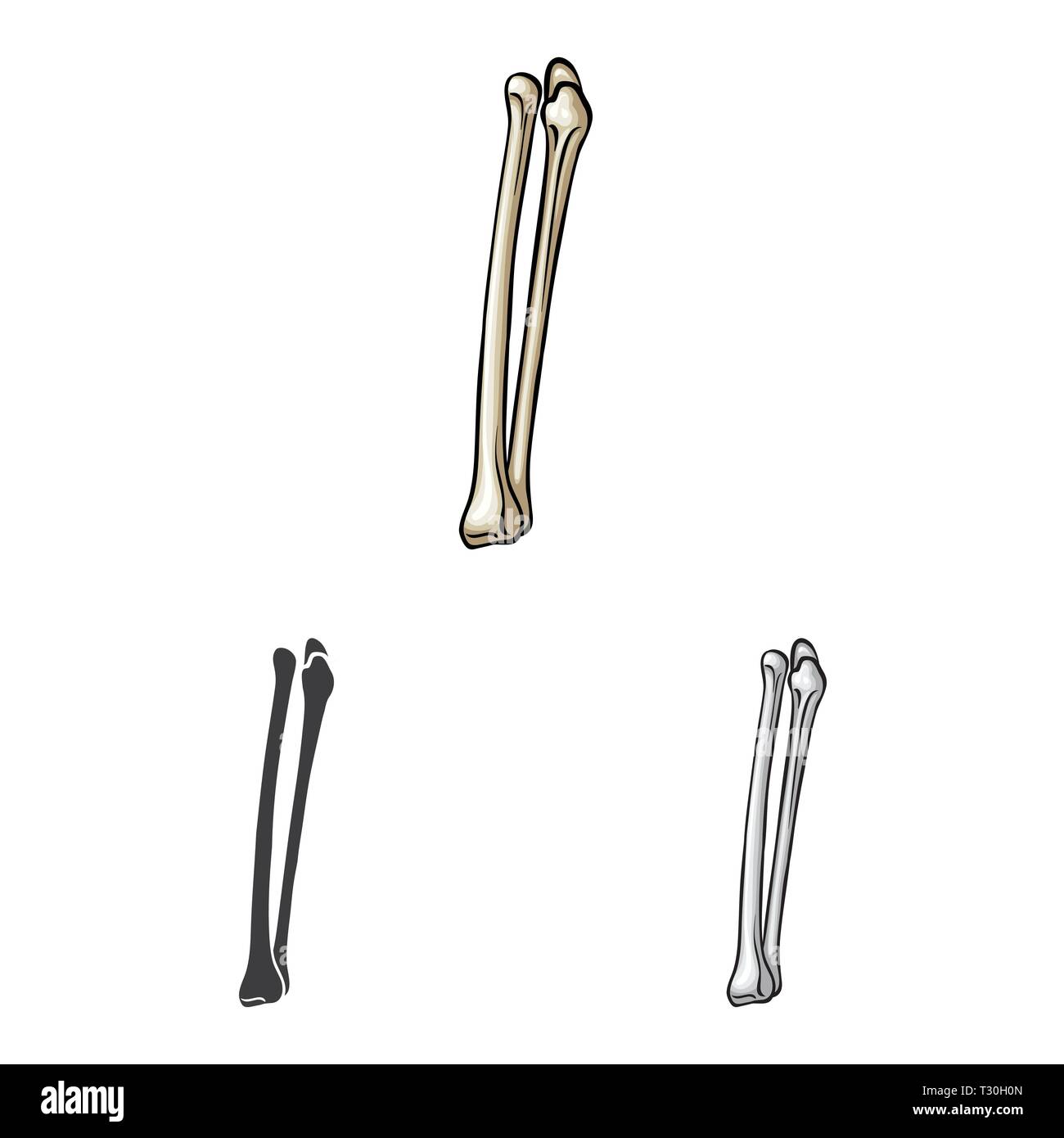 femur,leg,knee,tibia,fibula,alignment,calcium,surgery,medicine,clinic ...