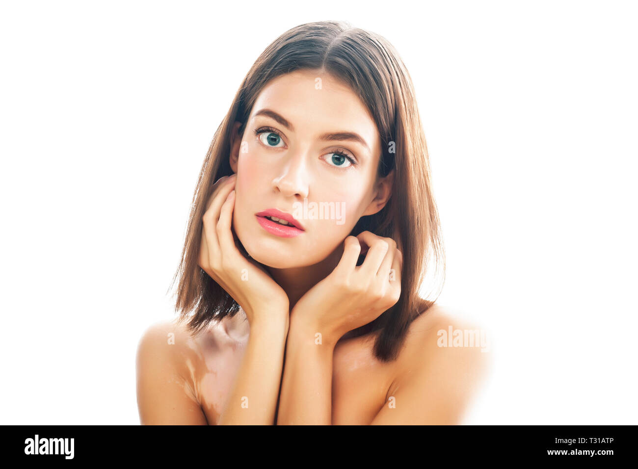 Vitiligo animal hi-res stock photography and images - Alamy