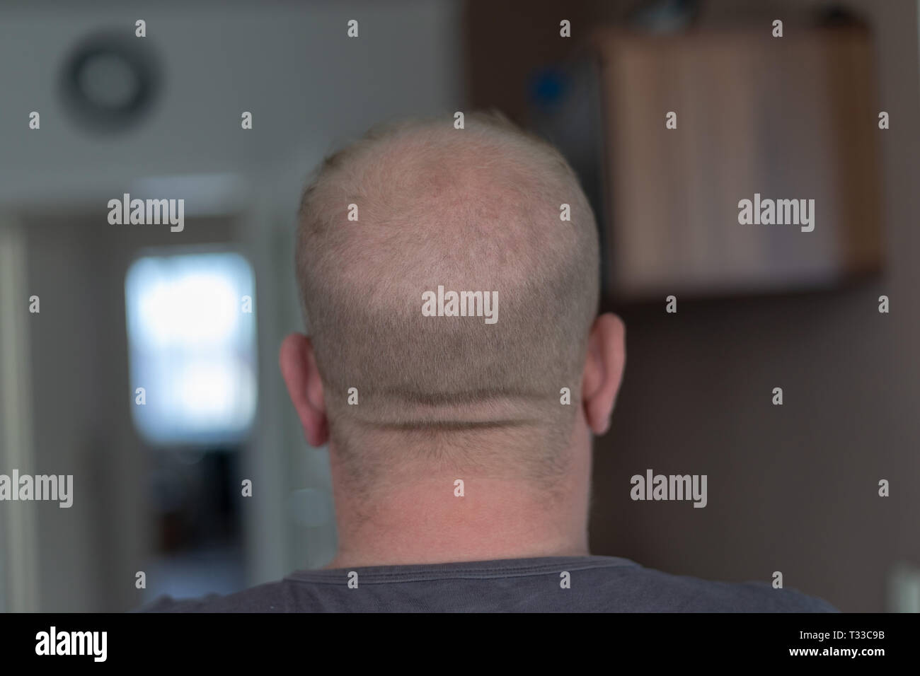 Balding head back view hi-res stock photography and images - Alamy
