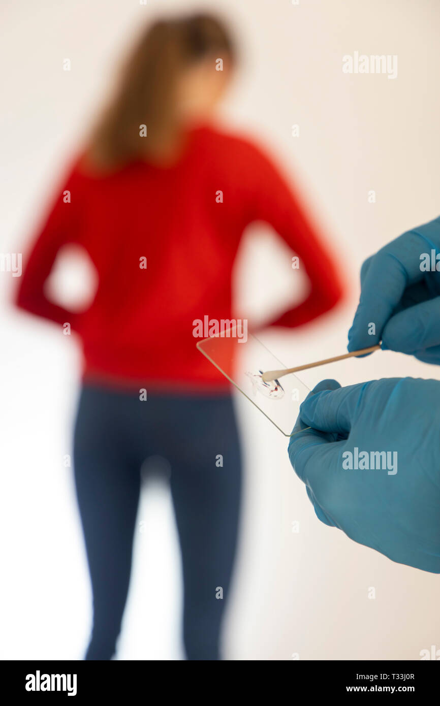 Cervical smear slides hi-res stock photography and images - Alamy
