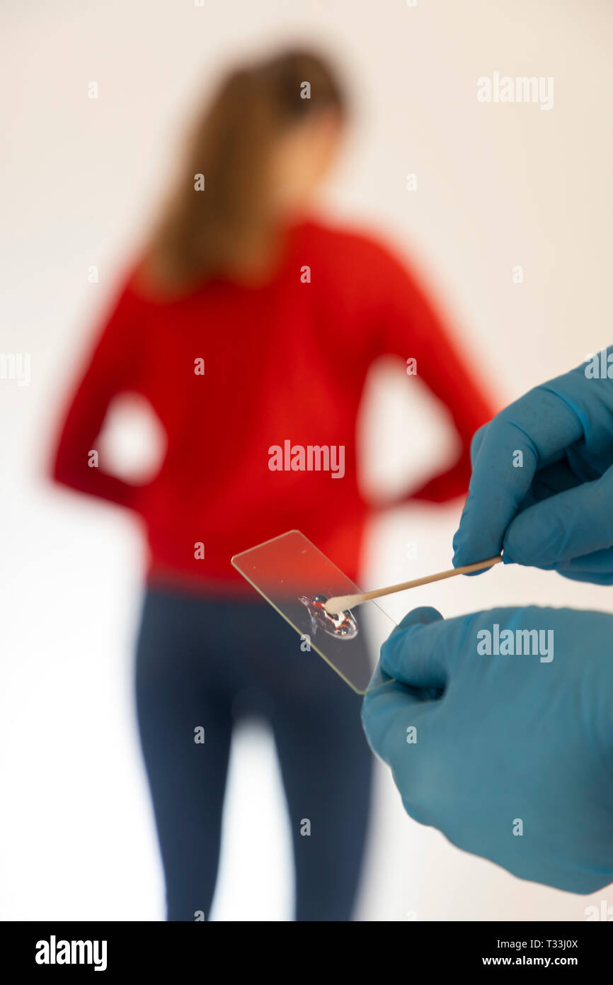 Cervical cancer, cervical carcinoma, smear after an examination of the ...