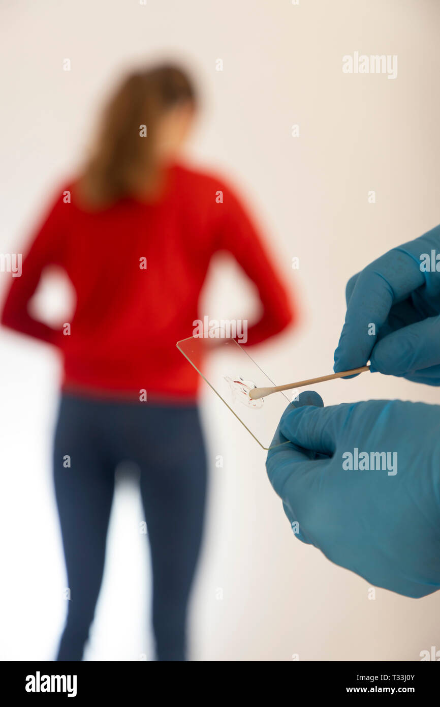 Cervical cancer, cervical carcinoma, smear after an examination of the ...