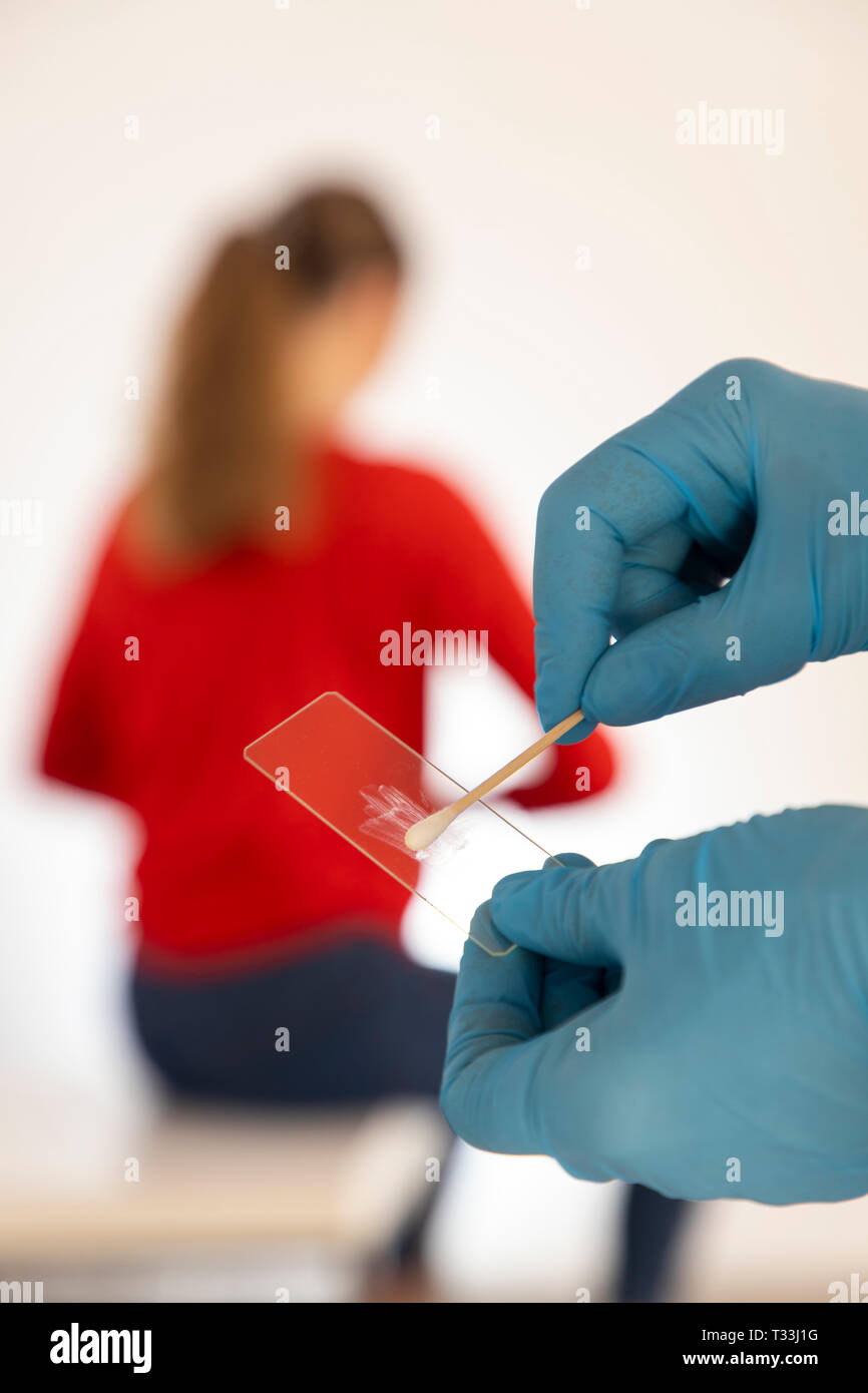 Cervical cancer, cervical carcinoma, smear after an examination of the ...
