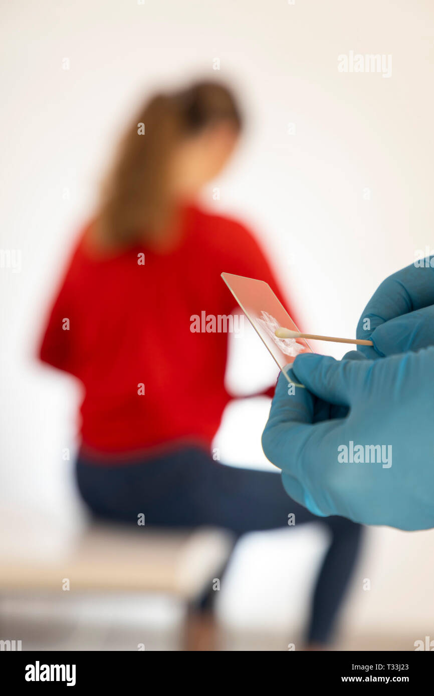 Cervical cancer, cervical carcinoma, smear after an examination of the ...