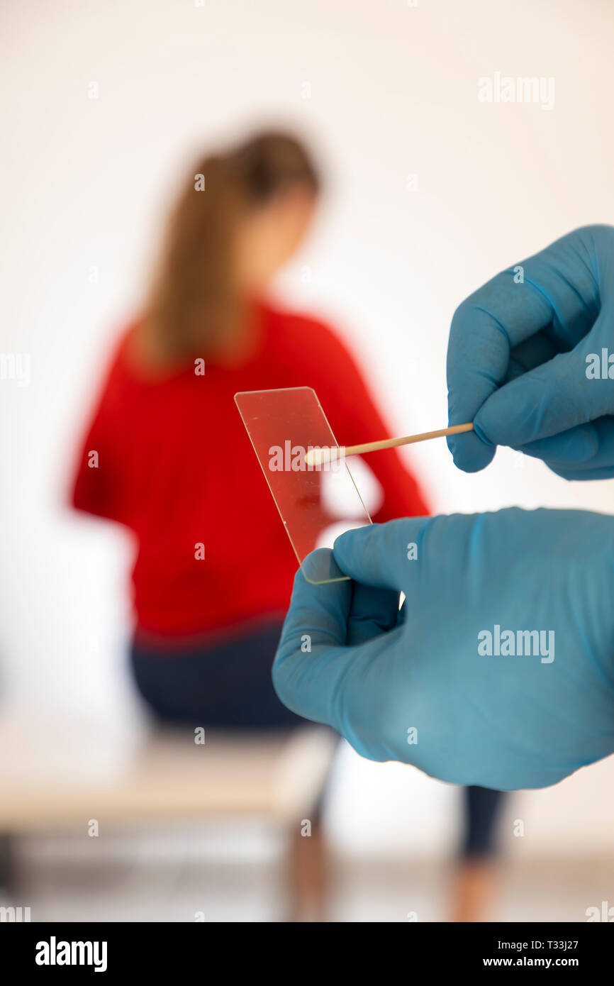 Cervical cancer, cervical carcinoma, smear after an examination of the ...