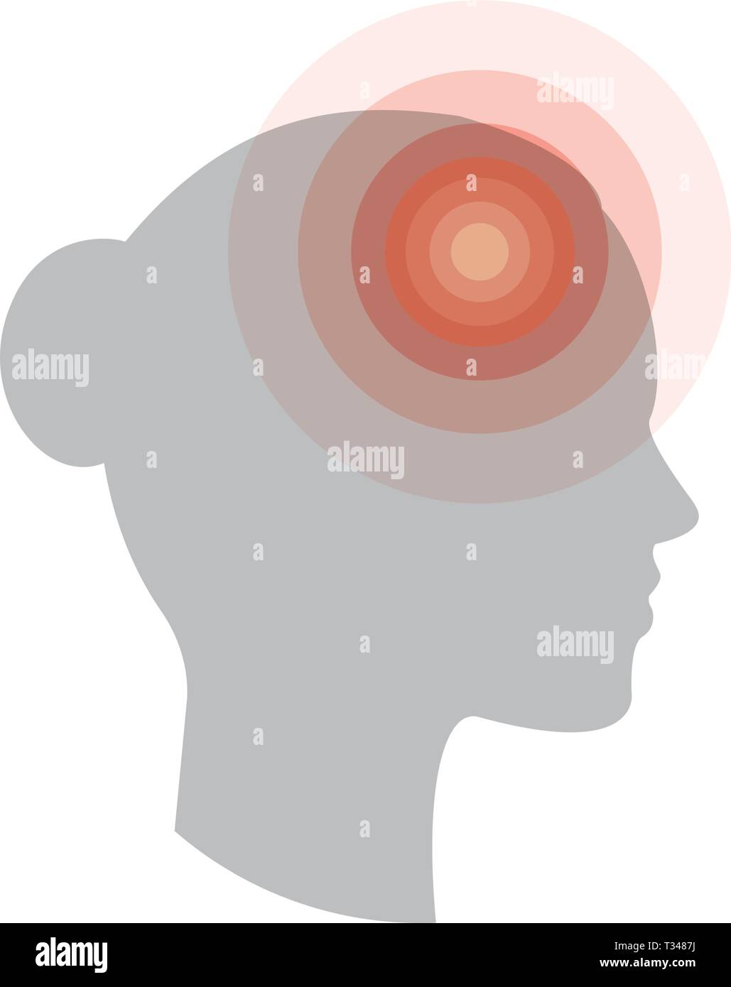 Medical icon. Woman head profile view. Headache, pain in the head ...