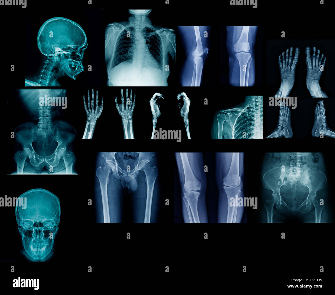 big collection x-ray image on black or dark background, hight quality ...