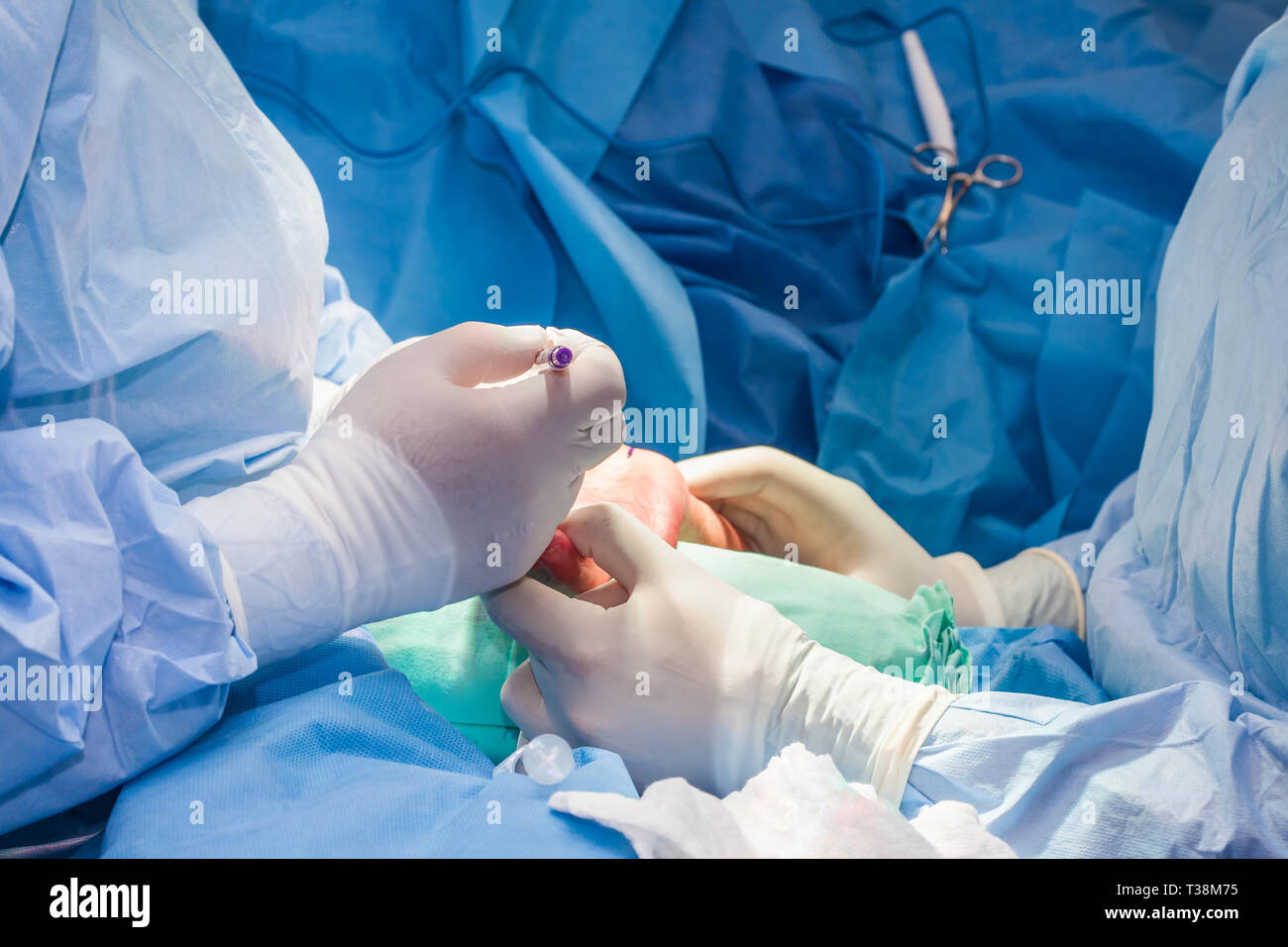 Doctors performing a surgery hi-res stock photography and images - Alamy