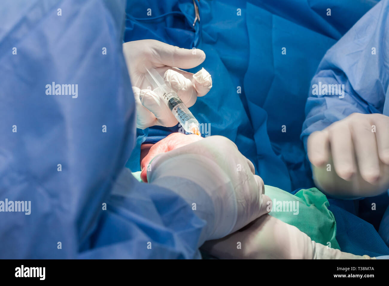 Doctors performing a surgery hi-res stock photography and images - Alamy