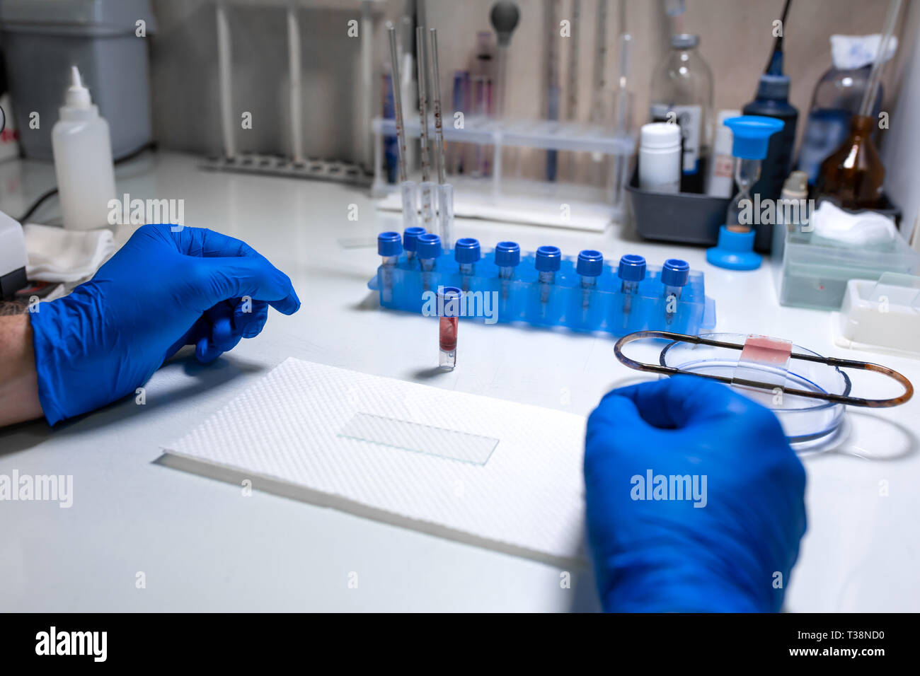 scientist prepare blood sample for research on microscope. Placing ...