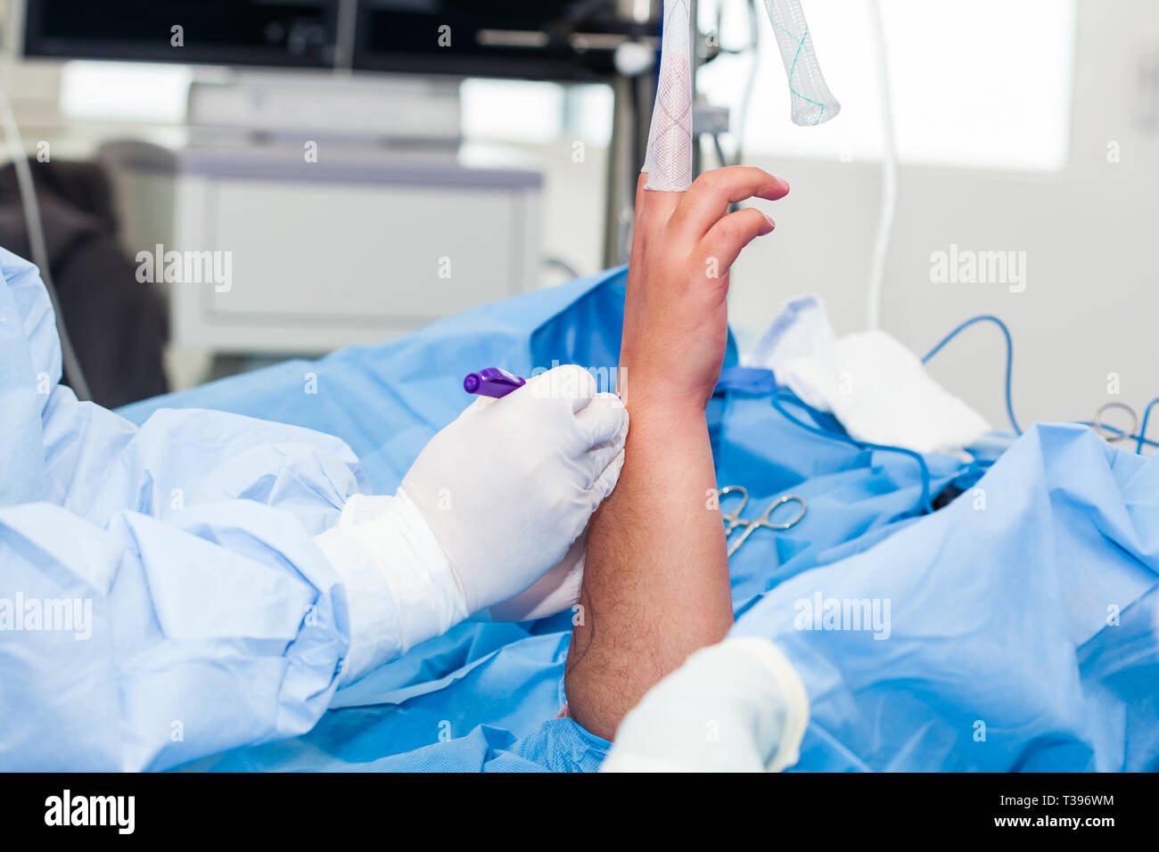 Orthopedic surgeon marking the surgical site just before performing a ...