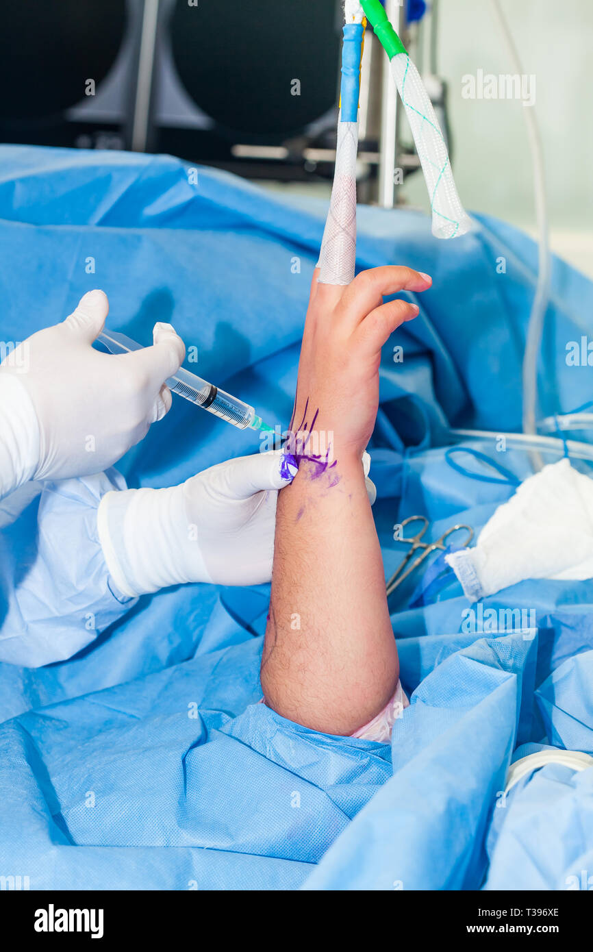 Group of orthopedic surgeons performing a wrist arthroscopy on a male ...