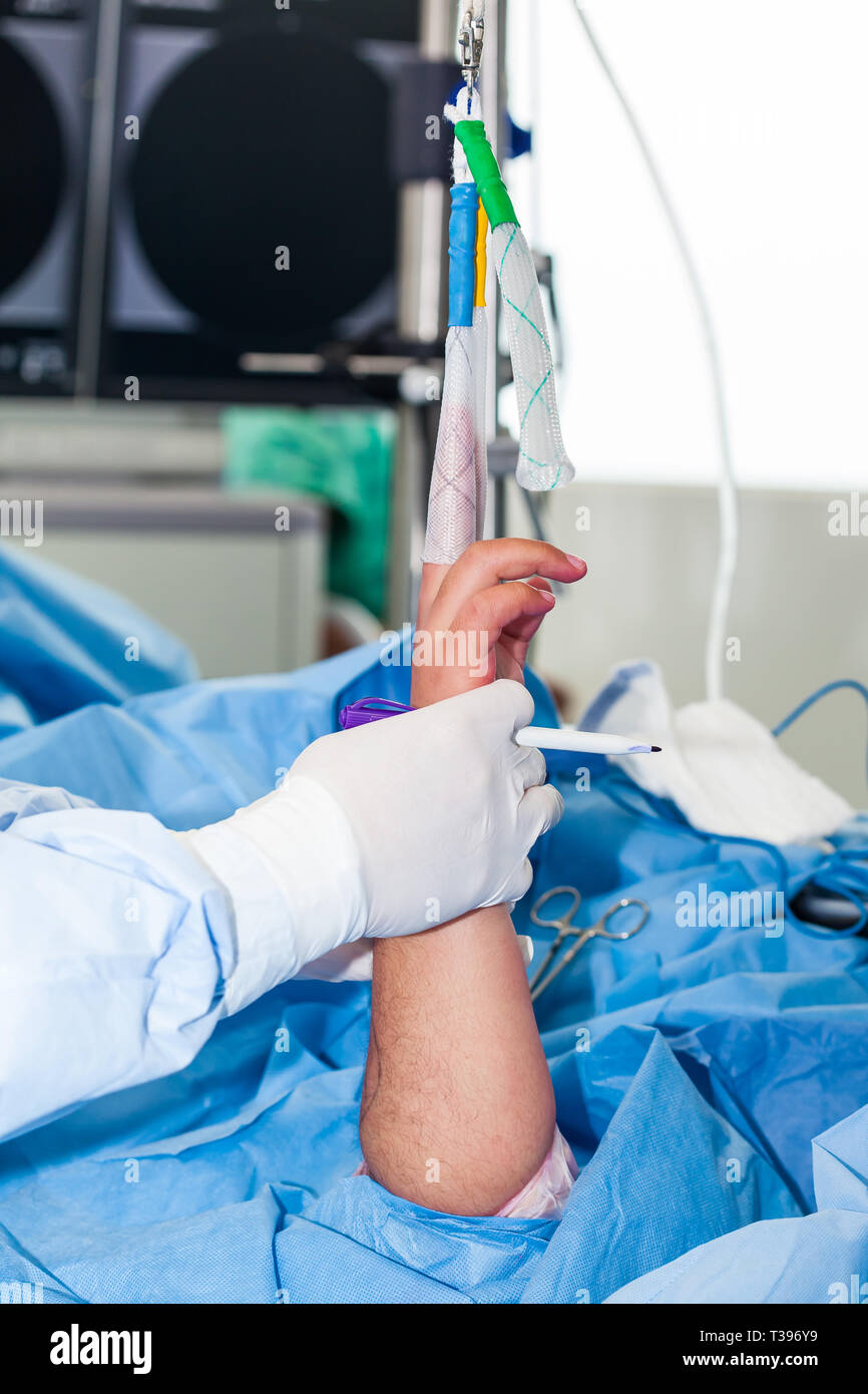 Surgical marking hi-res stock photography and images - Alamy