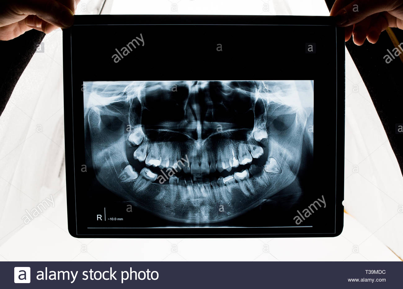 Teeth And Anatomy High Resolution Stock Photography and Images - Alamy