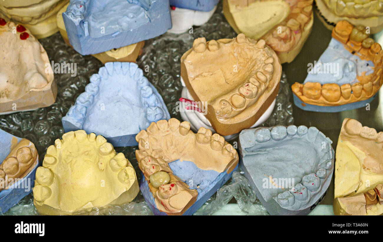 Dental impressions of teeth for manufacture of prostheses and ...