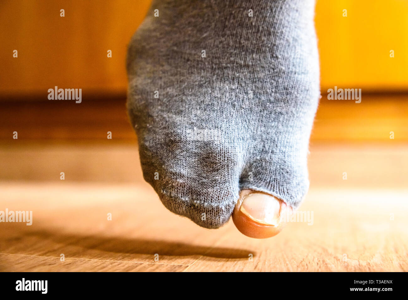 Broken sock with a hole in a man's big toe, concept of poverty during ...