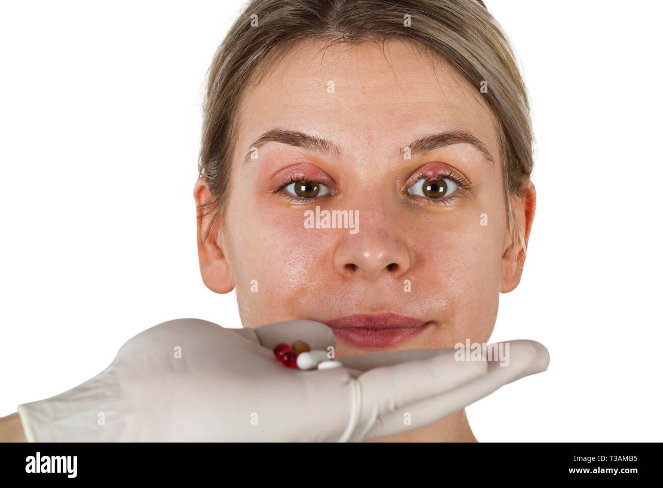 Abscess incision hi-res stock photography and images - Alamy