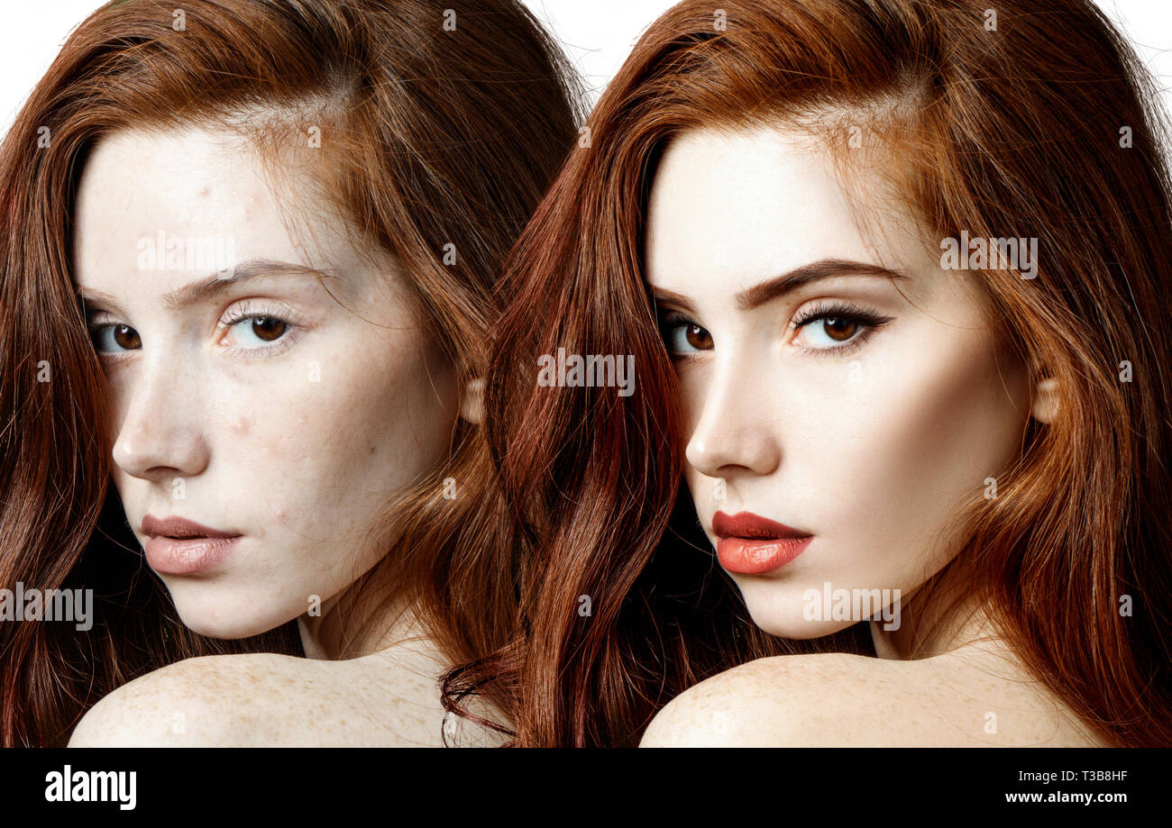 Young woman before and after skin treatment and makeup Stock Photo - Alamy