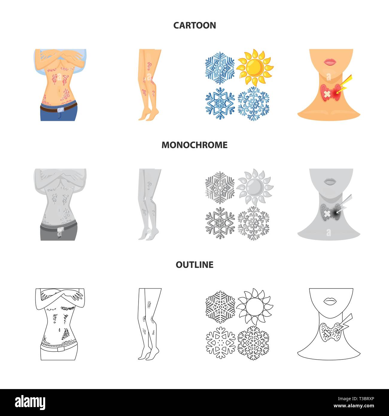 psoriasis,snowflake,endocrine,body,falling,system,skin,ice,neck,itch ...