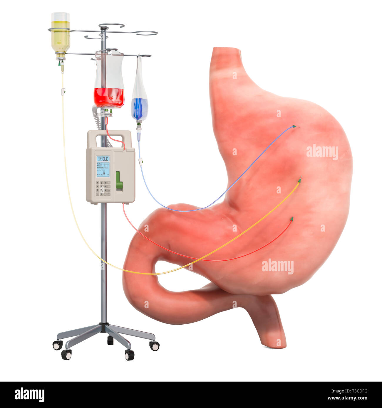 Intravenous therapy system with human stomach. Treatment and medicines ...