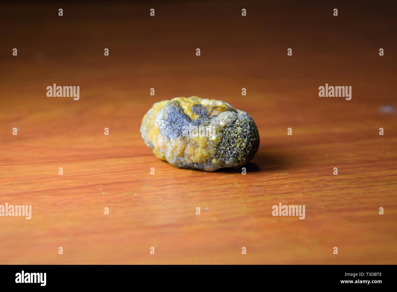 Pigmented epithelium hi-res stock photography and images - Alamy