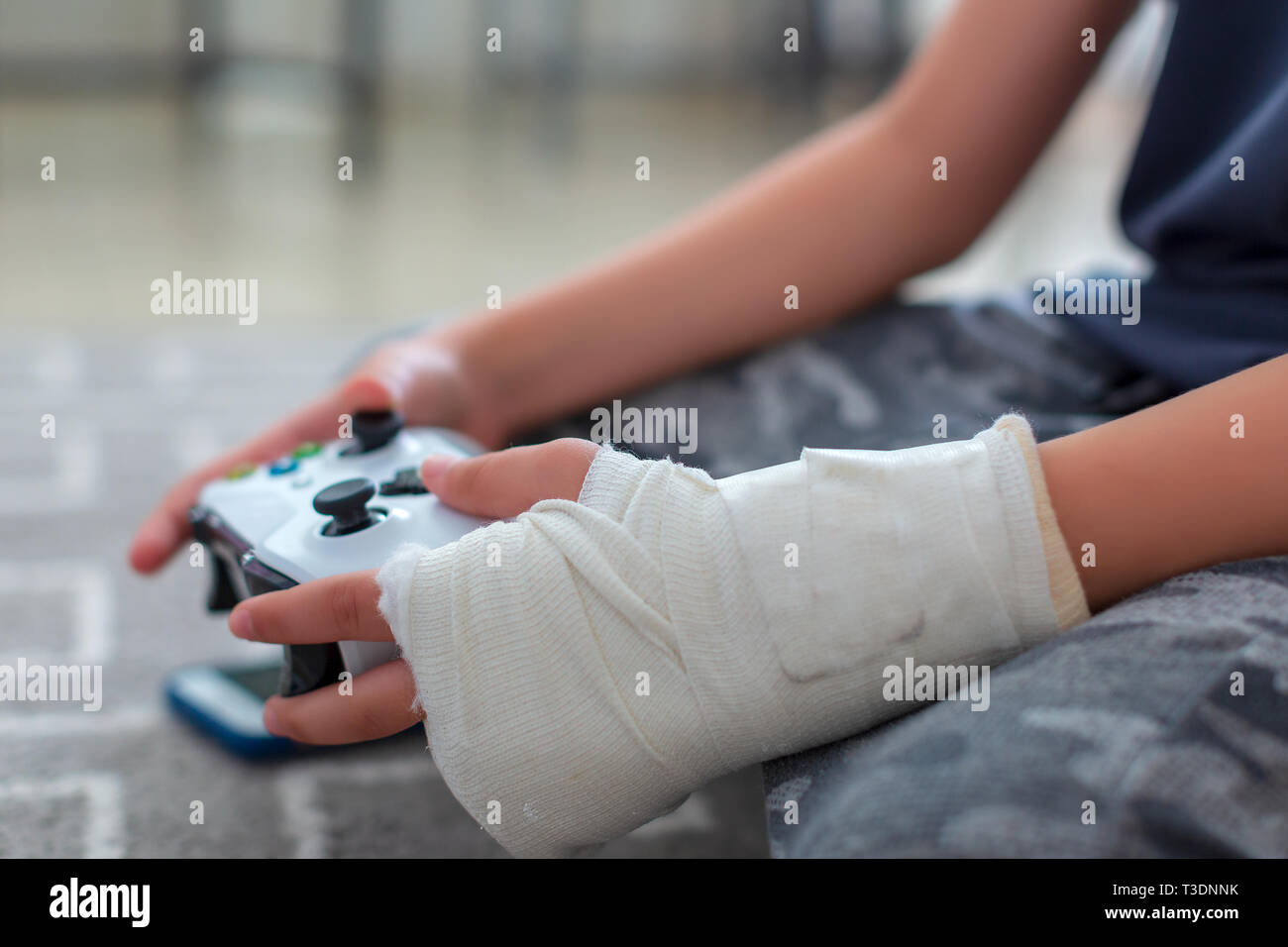Child with broken arm using video game controller Stock Photo - Alamy