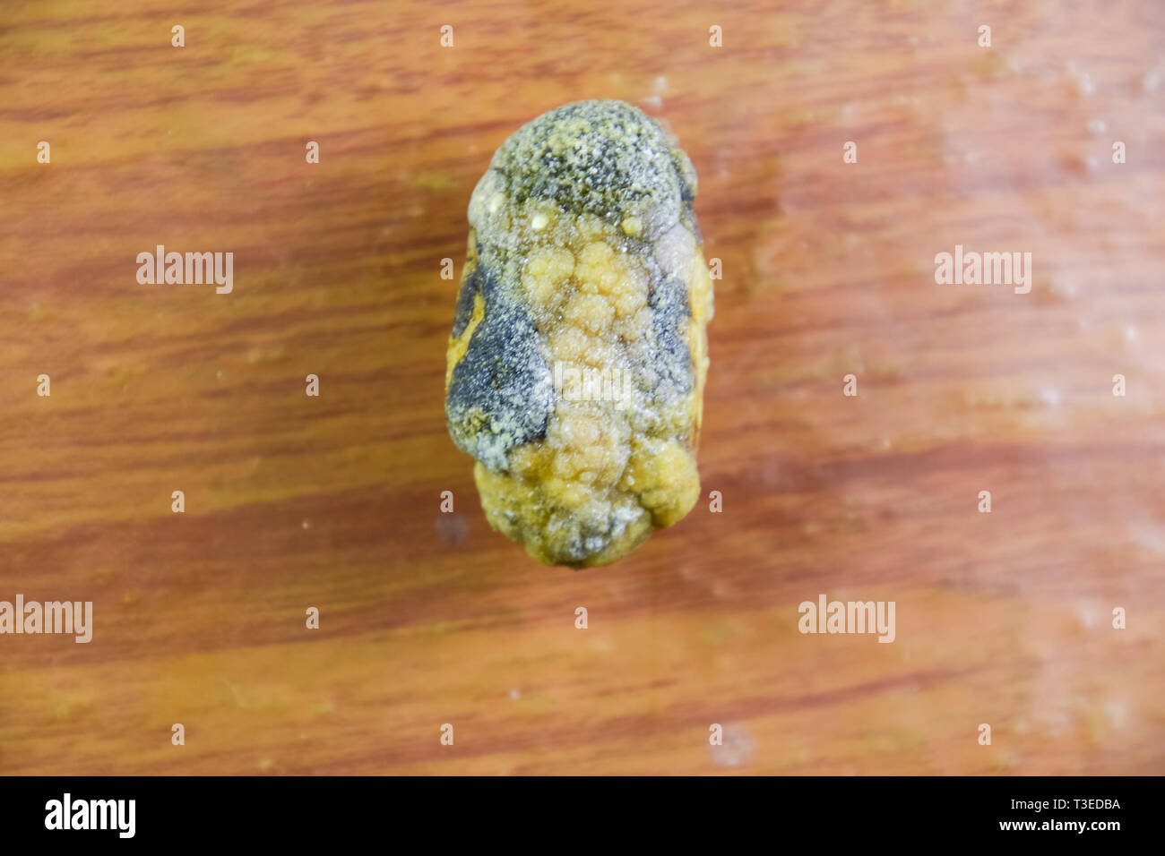 Pigmented epithelium hi-res stock photography and images - Alamy