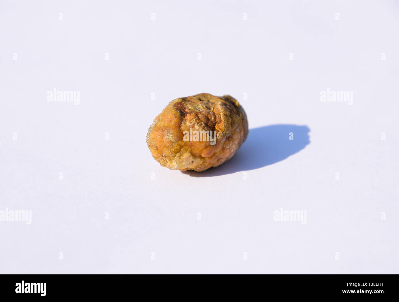 Human gallbladder anatomy stone hi-res stock photography and images - Alamy