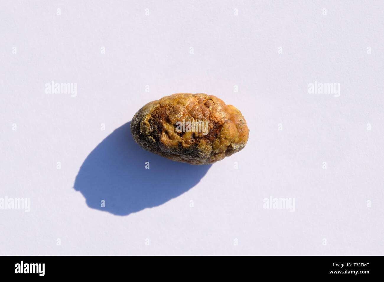 Gallbladder stone hi-res stock photography and images - Alamy