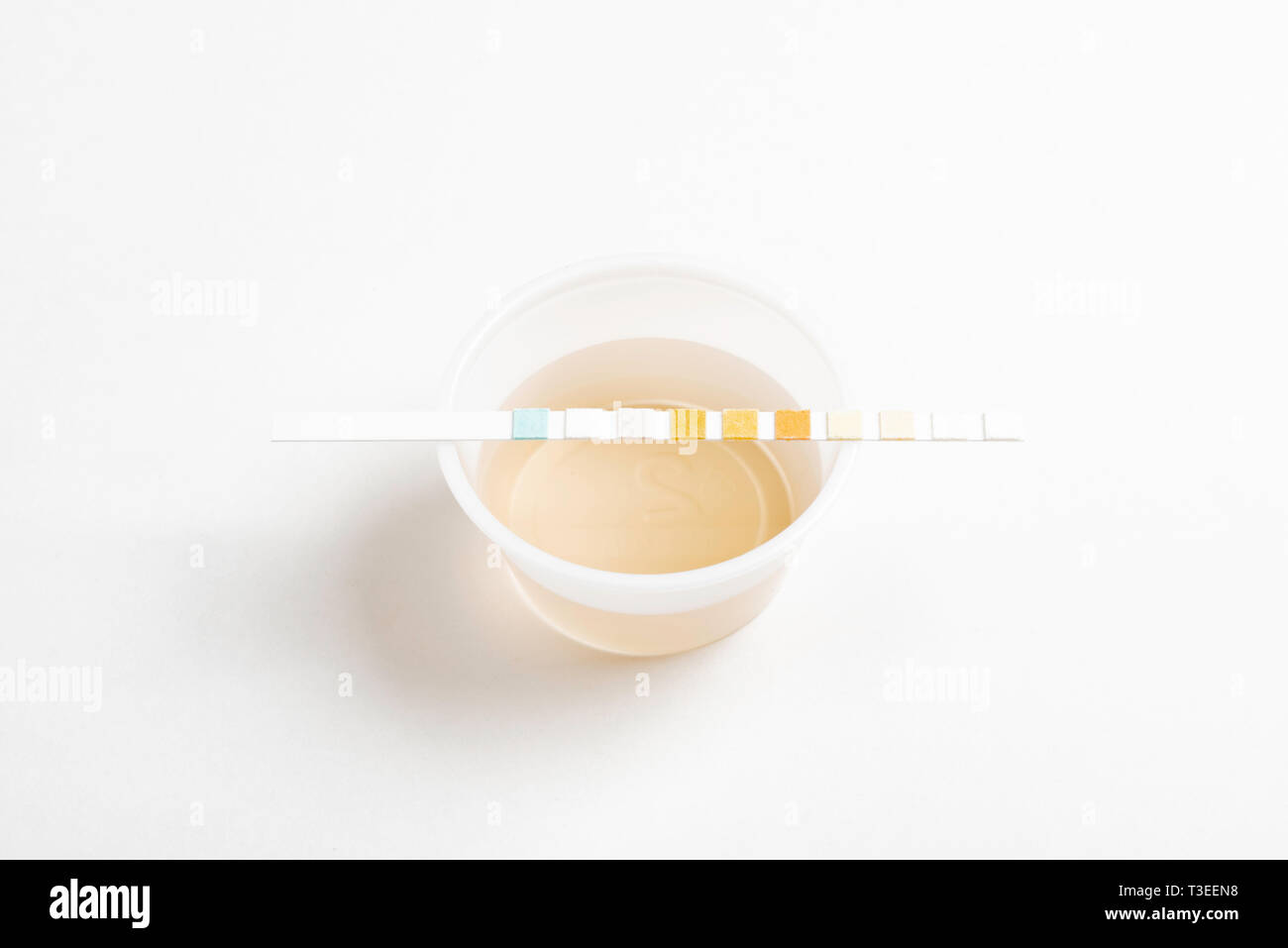 A combination of urine sample on a small round plastic container and a ...