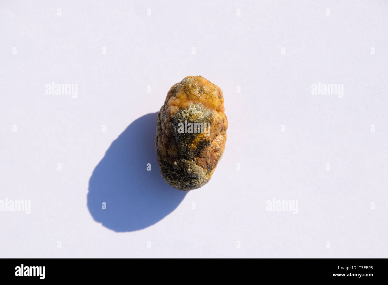 Stone of the gallbladder. The result of gallstones. A calculus of ...