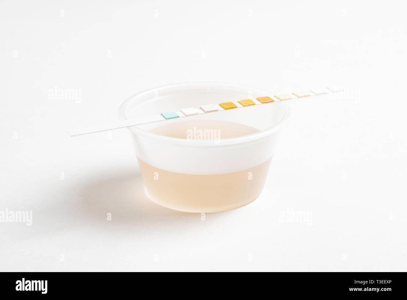 A combination of urine sample on a small round plastic container and a ...