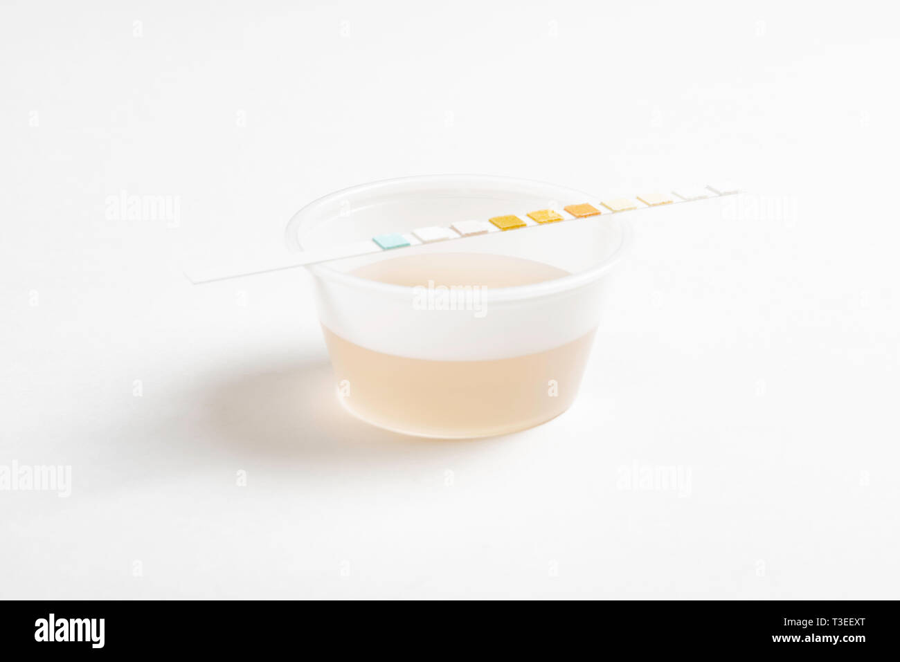 A combination of urine sample on a small round plastic container and a ...
