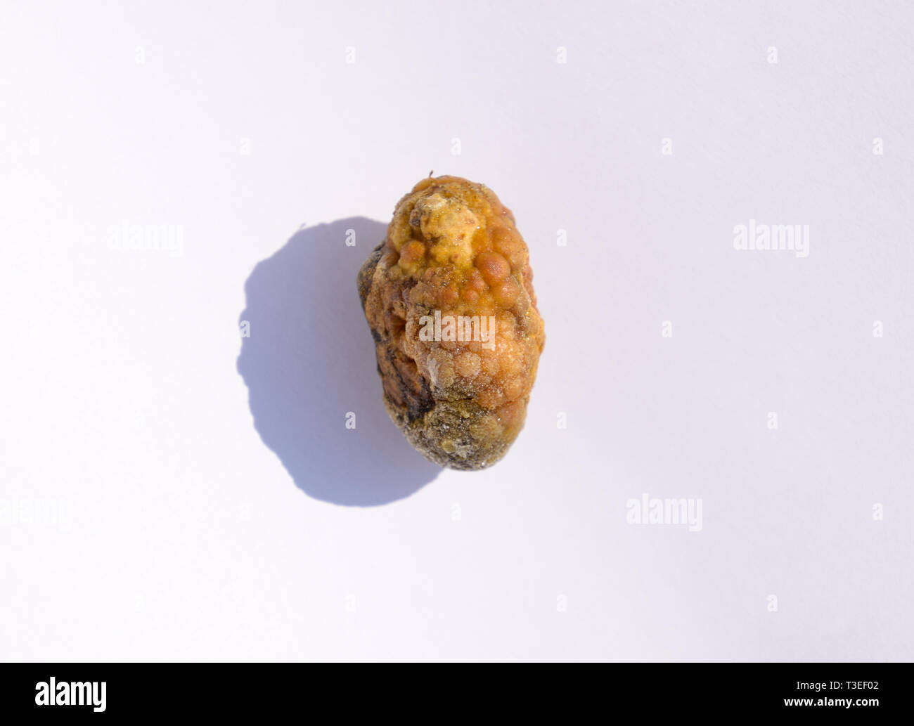 Gallbladder removal hi-res stock photography and images - Alamy