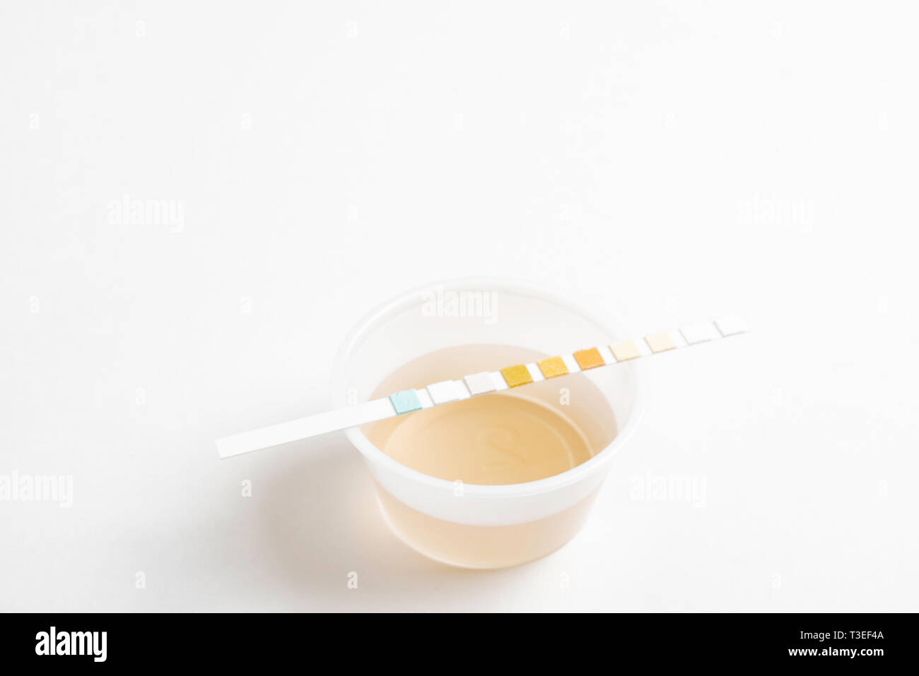 A combination of urine sample on a small round plastic container and a ...