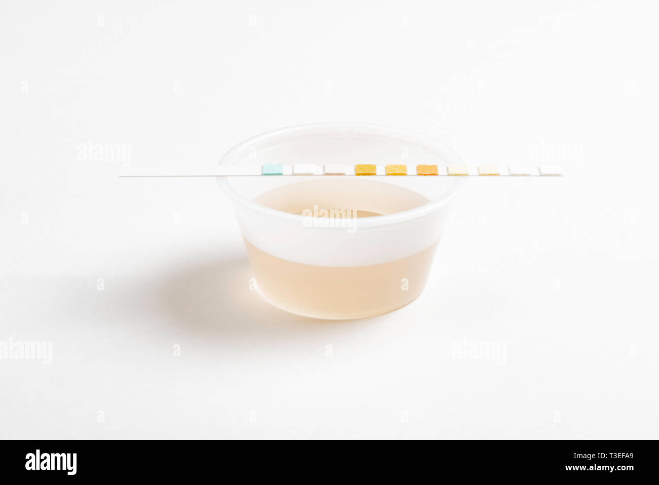 A combination of urine sample on a small round plastic container and a ...