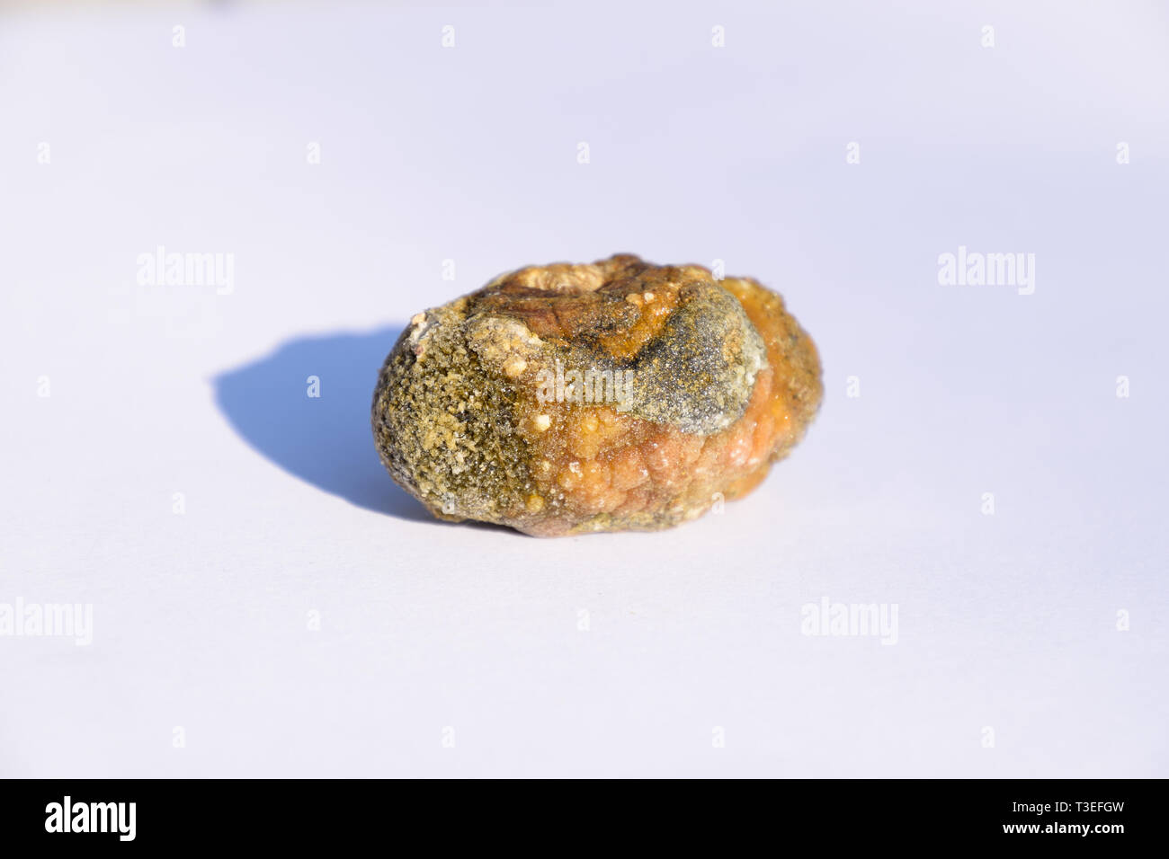 Gallbladder operation hi-res stock photography and images - Alamy