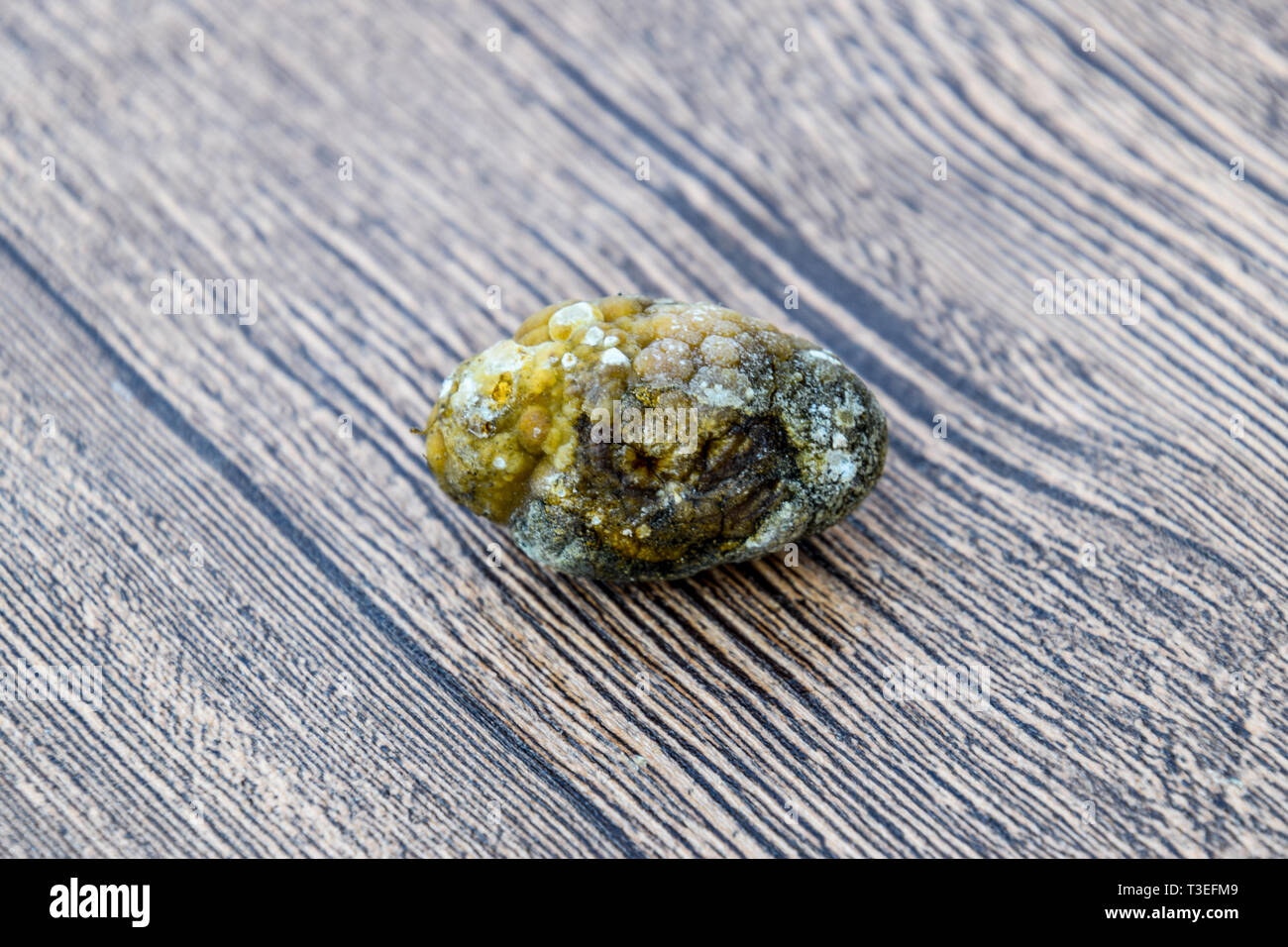 Human gallbladder anatomy stone hi-res stock photography and images - Alamy