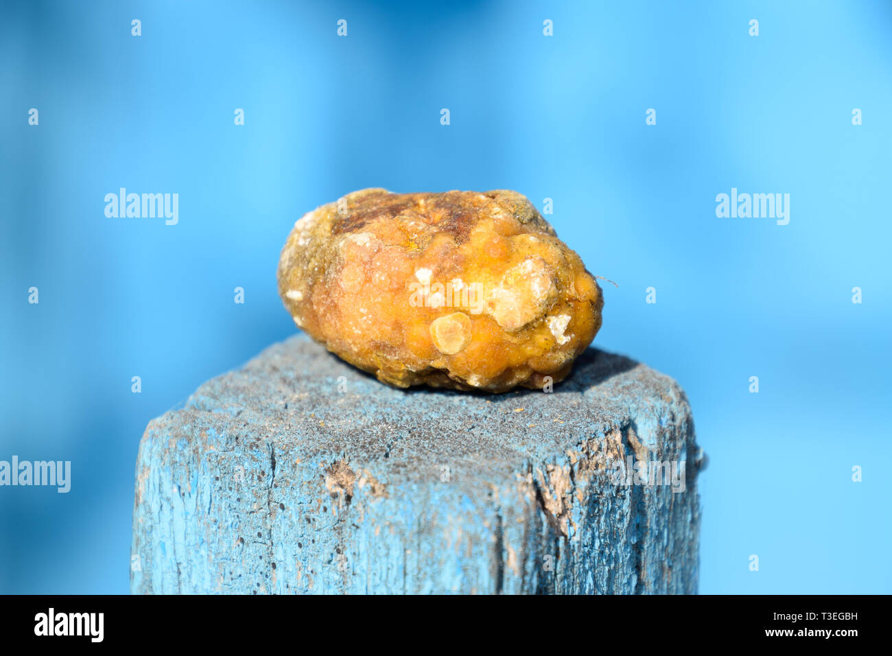 Gall bladder operation hi-res stock photography and images - Alamy