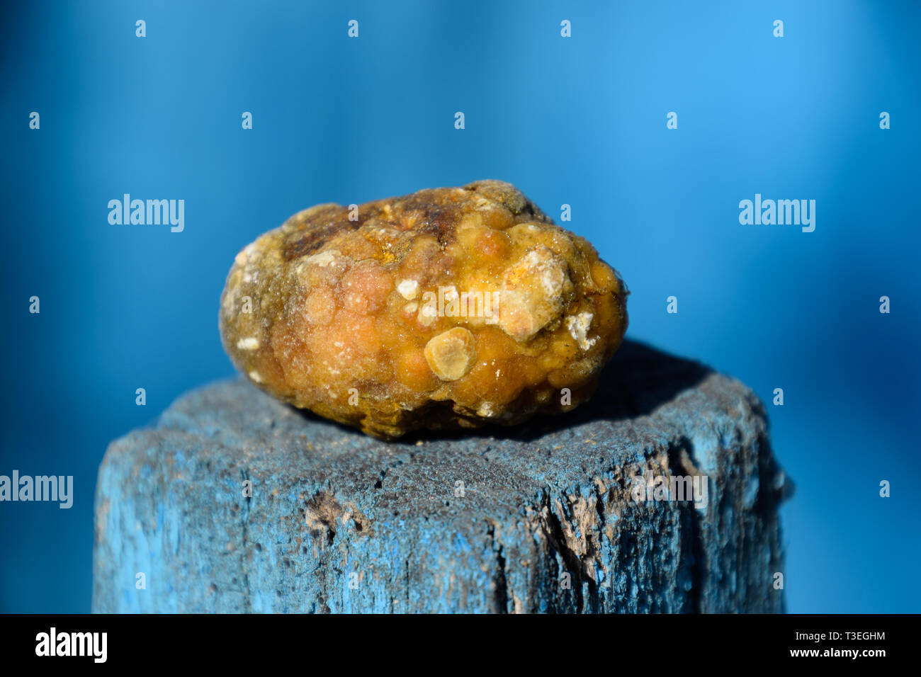 Calcium phosphate stone hi-res stock photography and images - Alamy