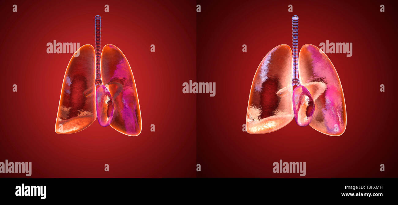 Breathing Process High Resolution Stock Photography and Images - Alamy