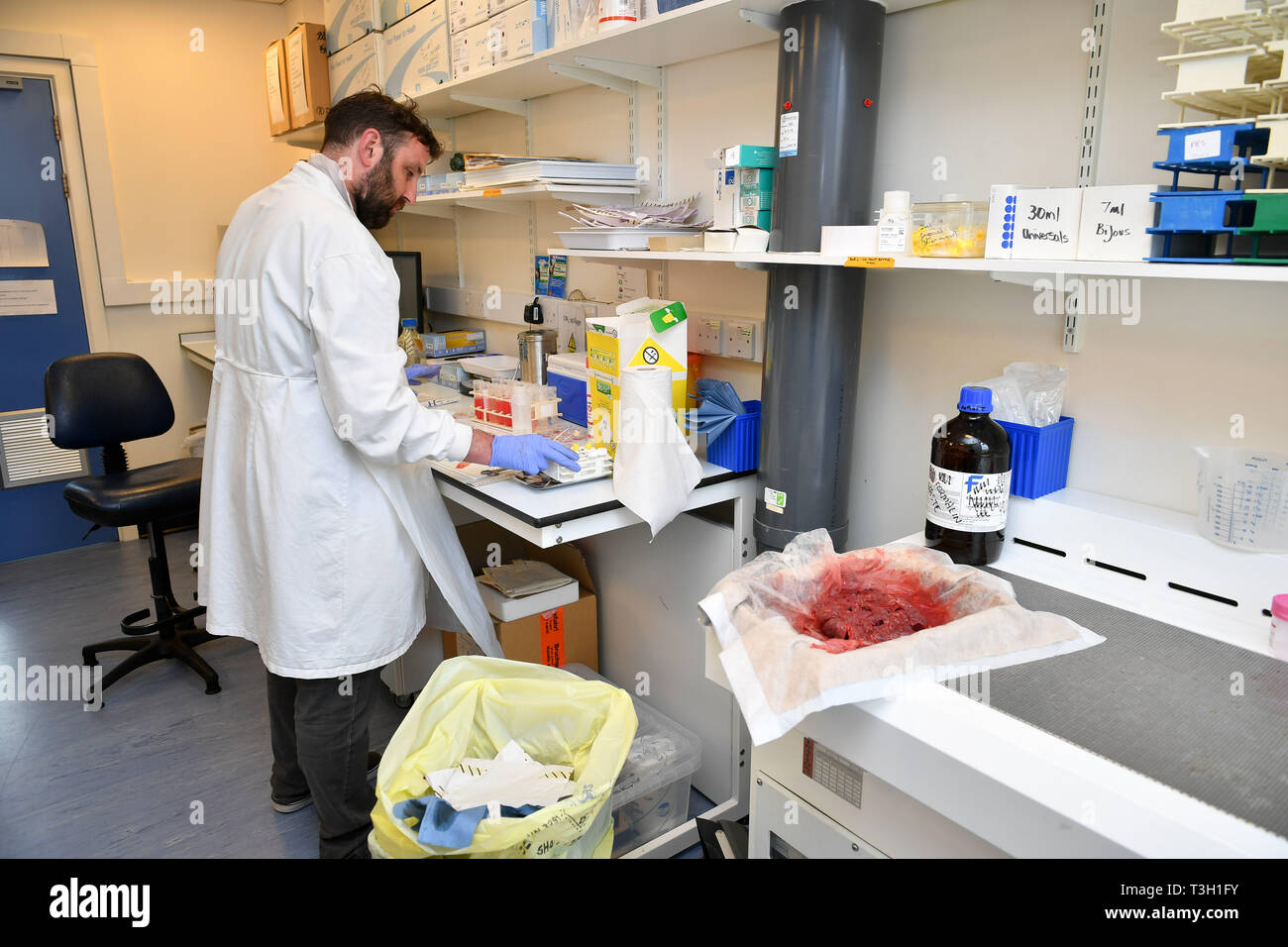 Placenta tissues hi-res stock photography and images - Alamy