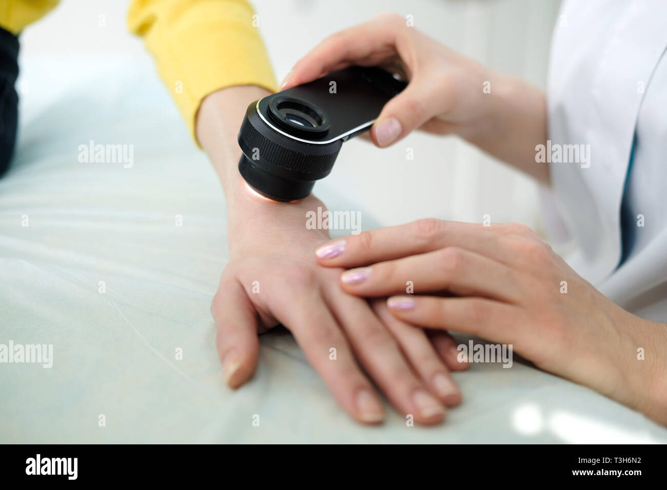 Female dermatologist using a professional dermatoscope while doing skin ...