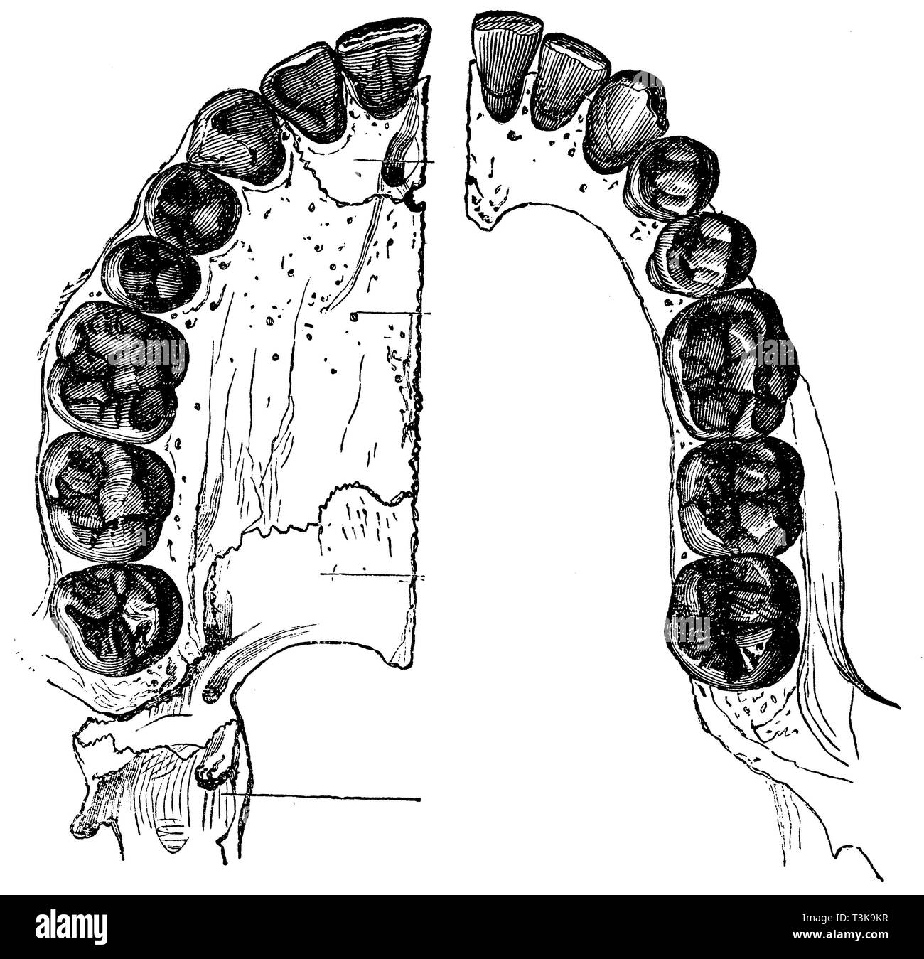 Teeth human engraving hi-res stock photography and images - Alamy