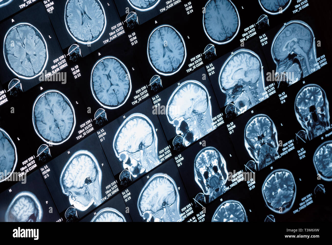 Mri scan body hi-res stock photography and images - Alamy