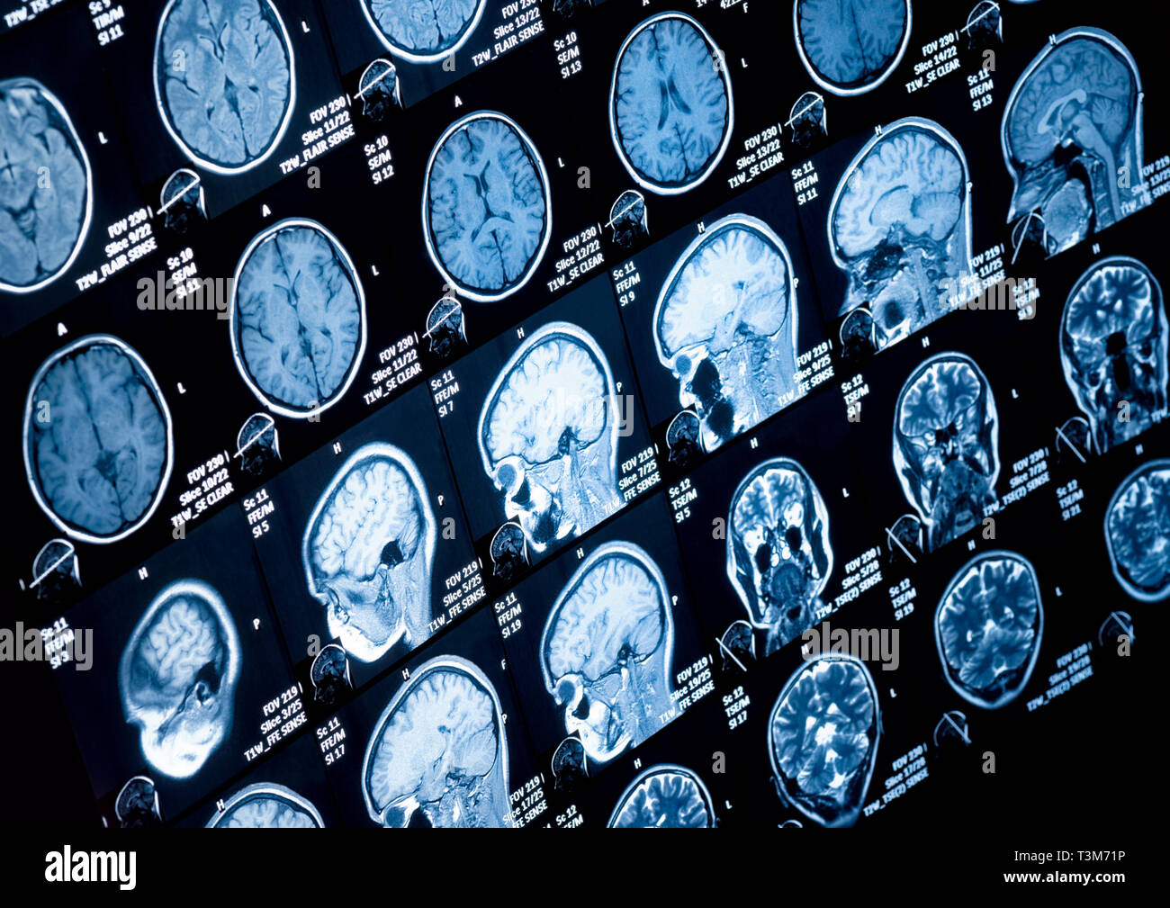 Head and neck MRI scan, patient's and clinic's info removed, toned ...