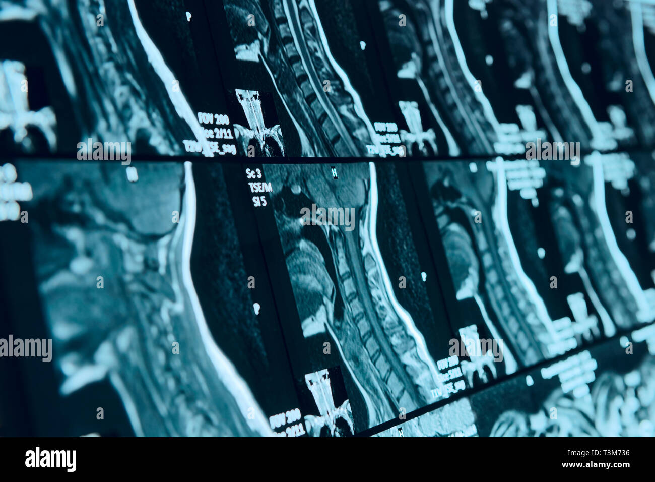 Head and neck MRI scan, anonymized, shallow focus depth Stock Photo - Alamy